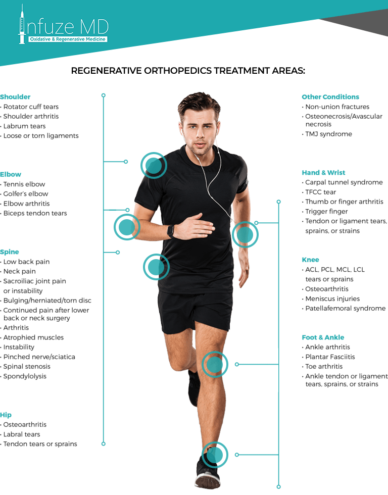 Prolozone - Infuze MD